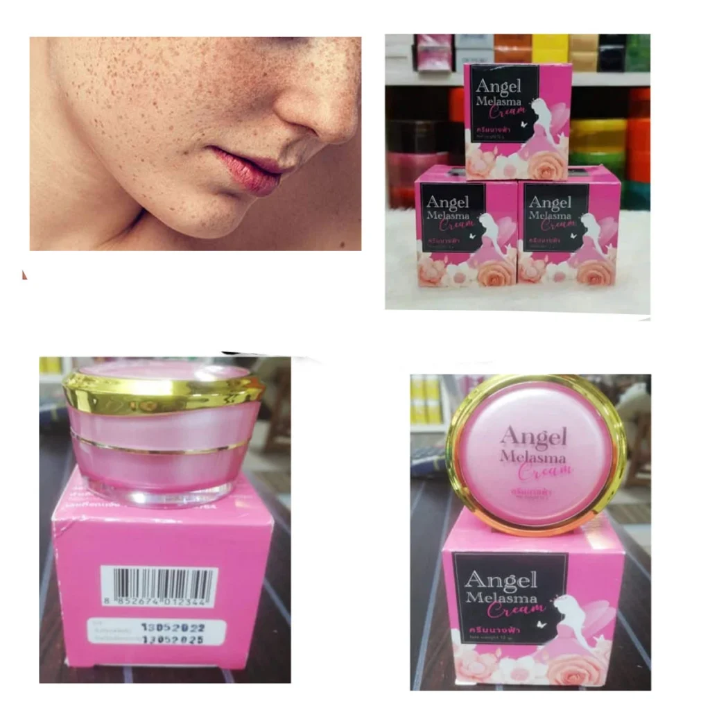 Angel MELASMA Cream 12g Price in Bangladesh